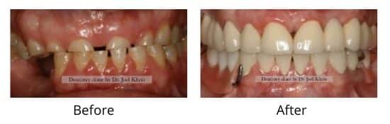 Smile Gallery | Corpus Christi | Tide Dental & Orthodontics